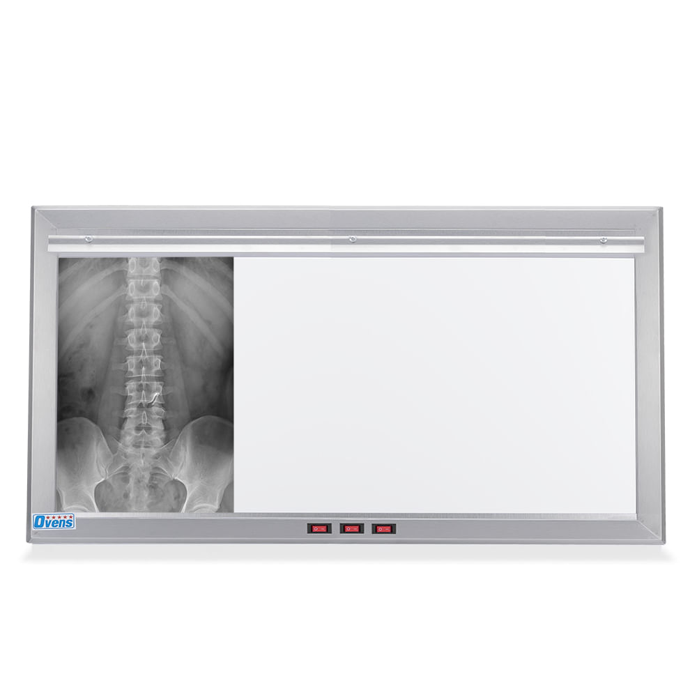 Negatoscopio LED de 3 Campos en Acero Satinado | Promart.pe - Promart